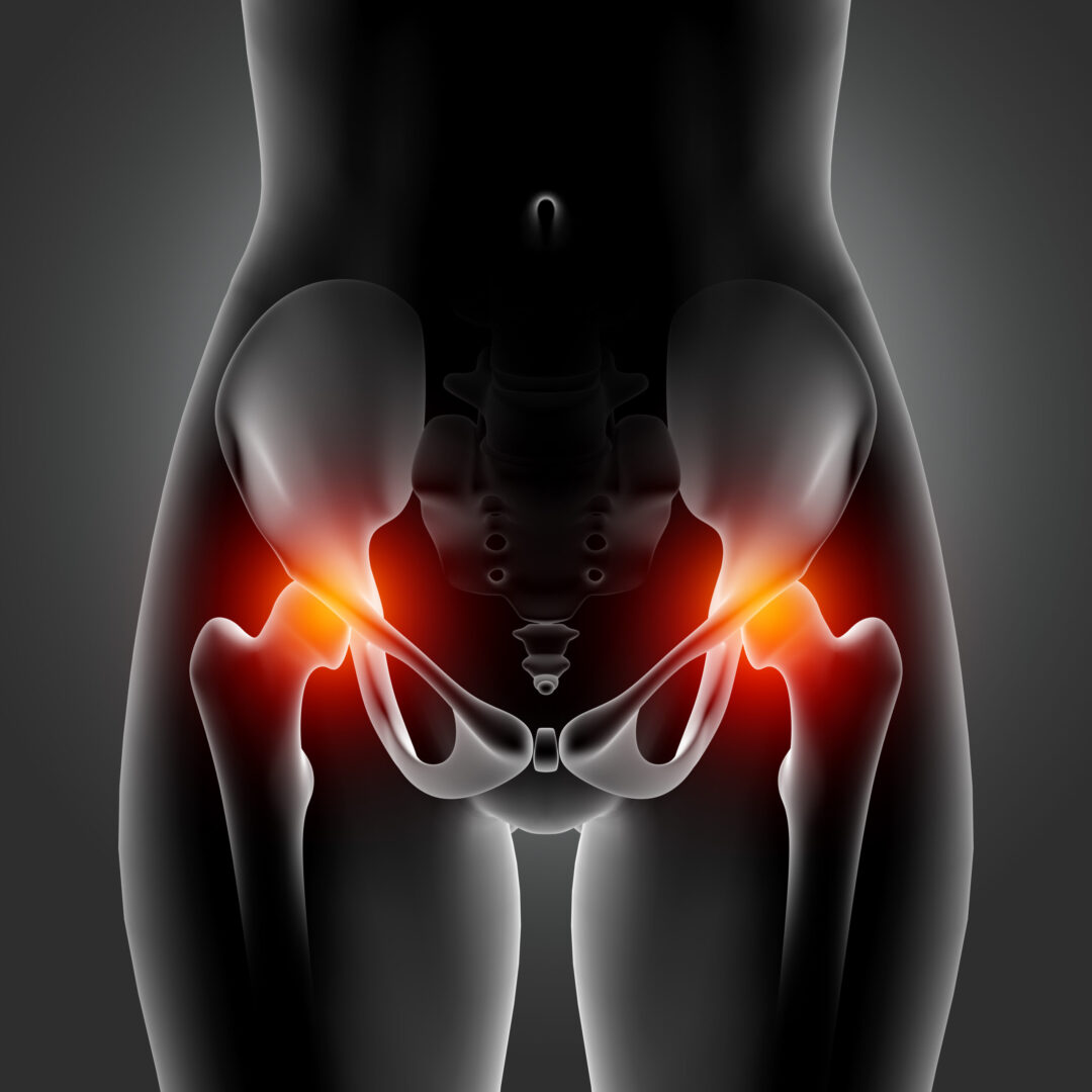 Hip Pain Treatment in Dubai
