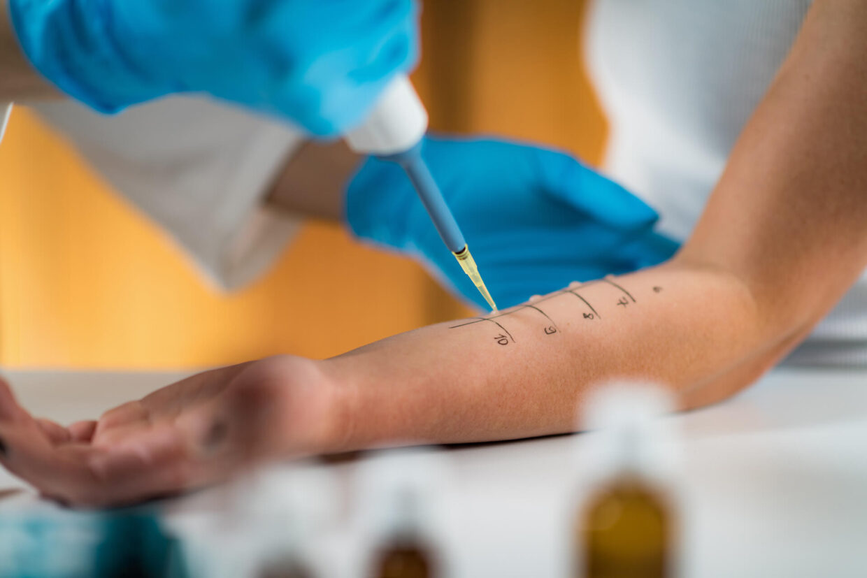 Allergies Testing & Treatments in Dubai, UAE | Novomed Allergery Center